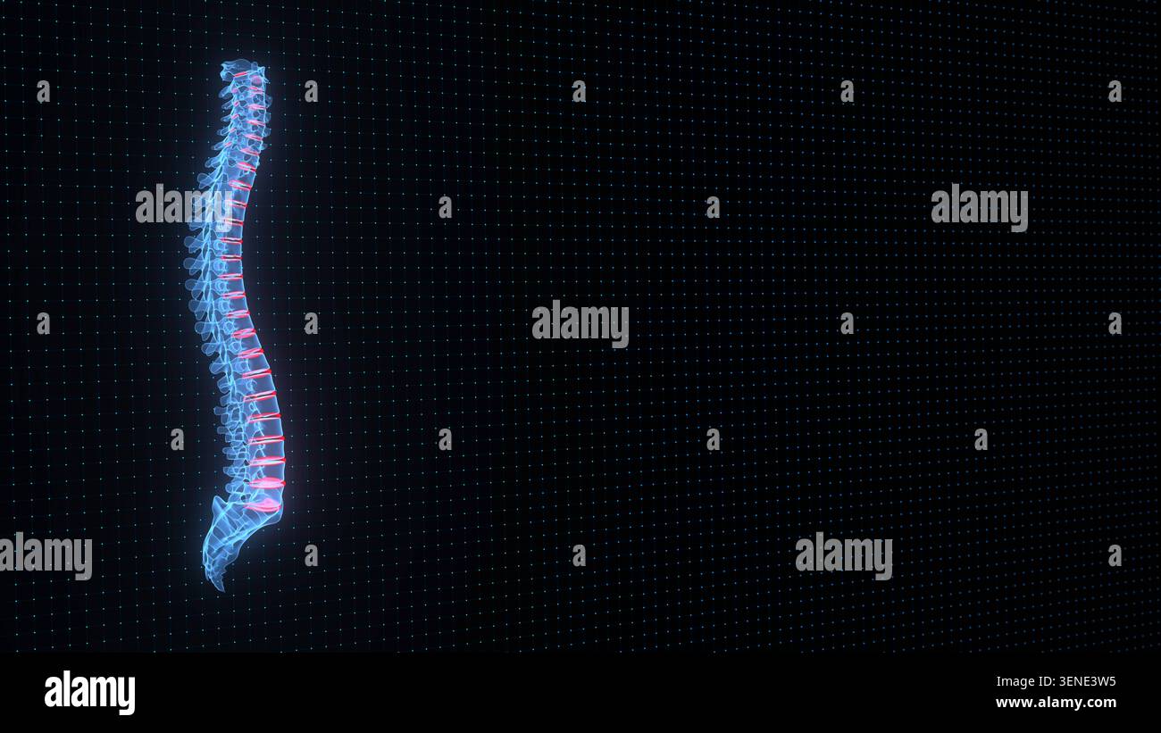 Spine anatomy with highlighted intervertebral discs for physioth ...