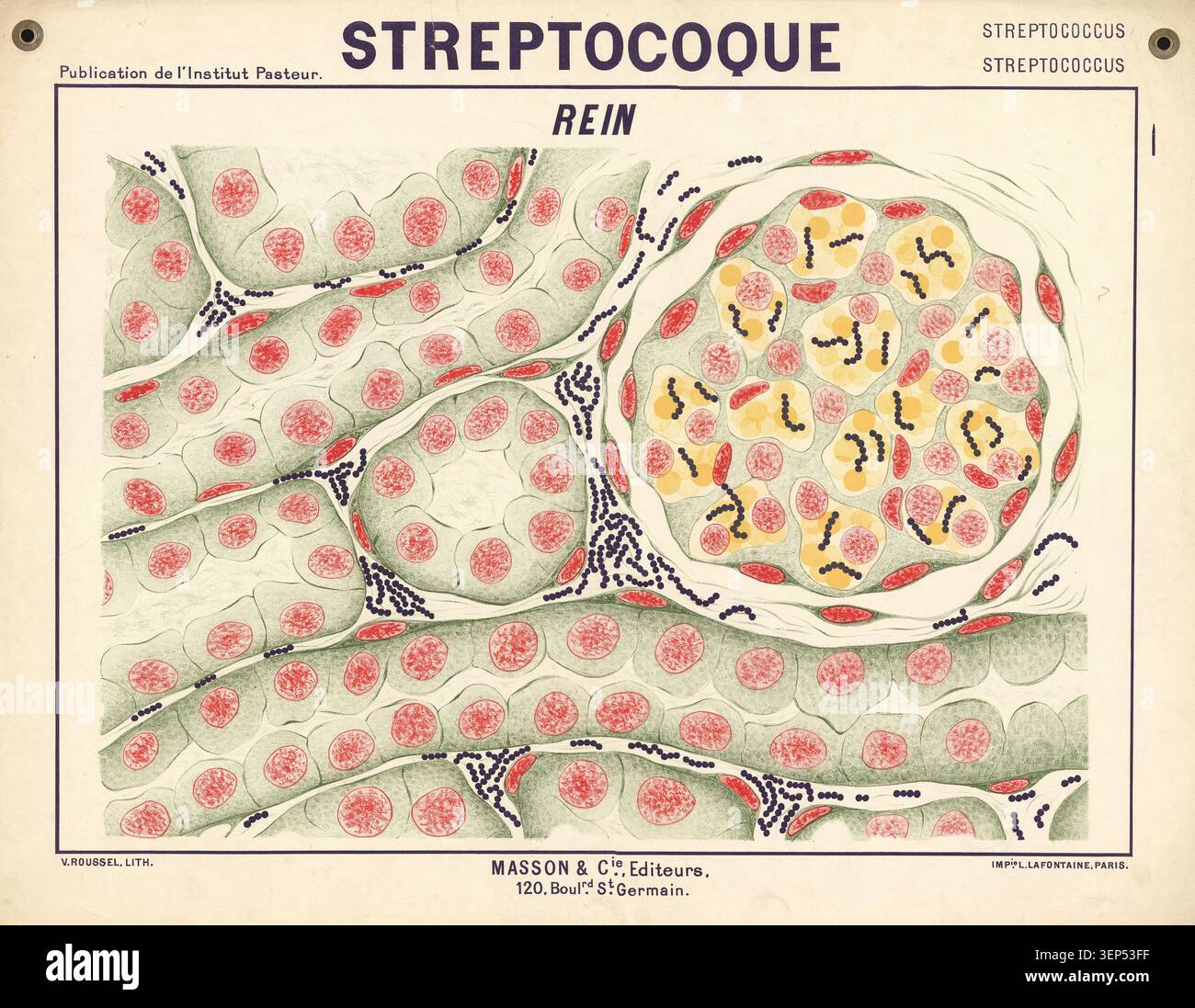 Medical science pedagogy bacterial infection diagram france hi-res ...