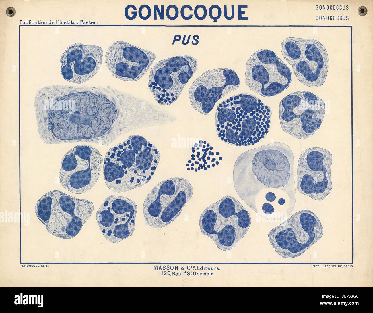 Medical science pedagogy bacterial infection diagram france hi-res ...
