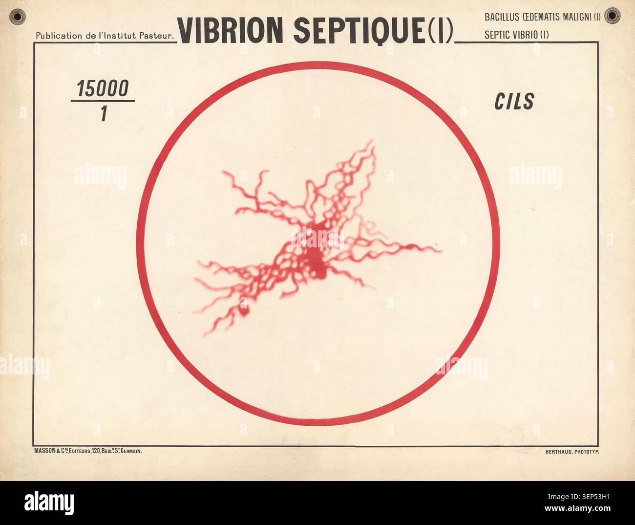 Medical science pedagogy bacterial infection diagram france hi-res ...