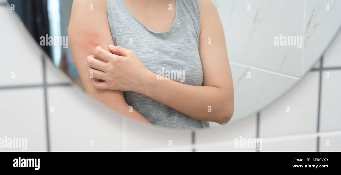 skin problem and beauty. Young woman scratch body has itchy skin from ...