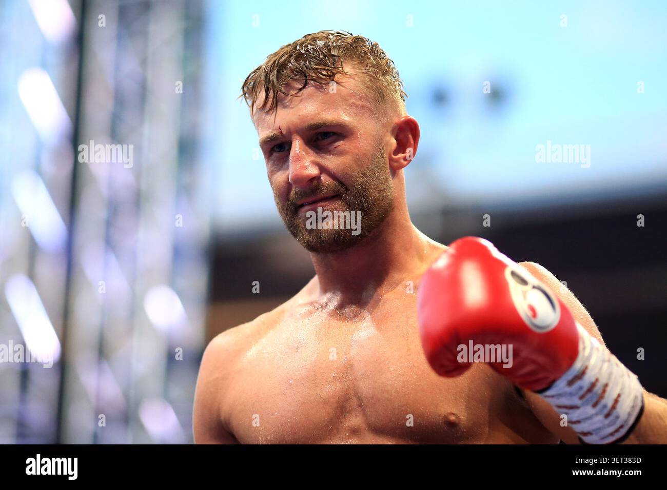 Lewis Edmondson after the middleweight bout against Lyndon Arthur (not ...