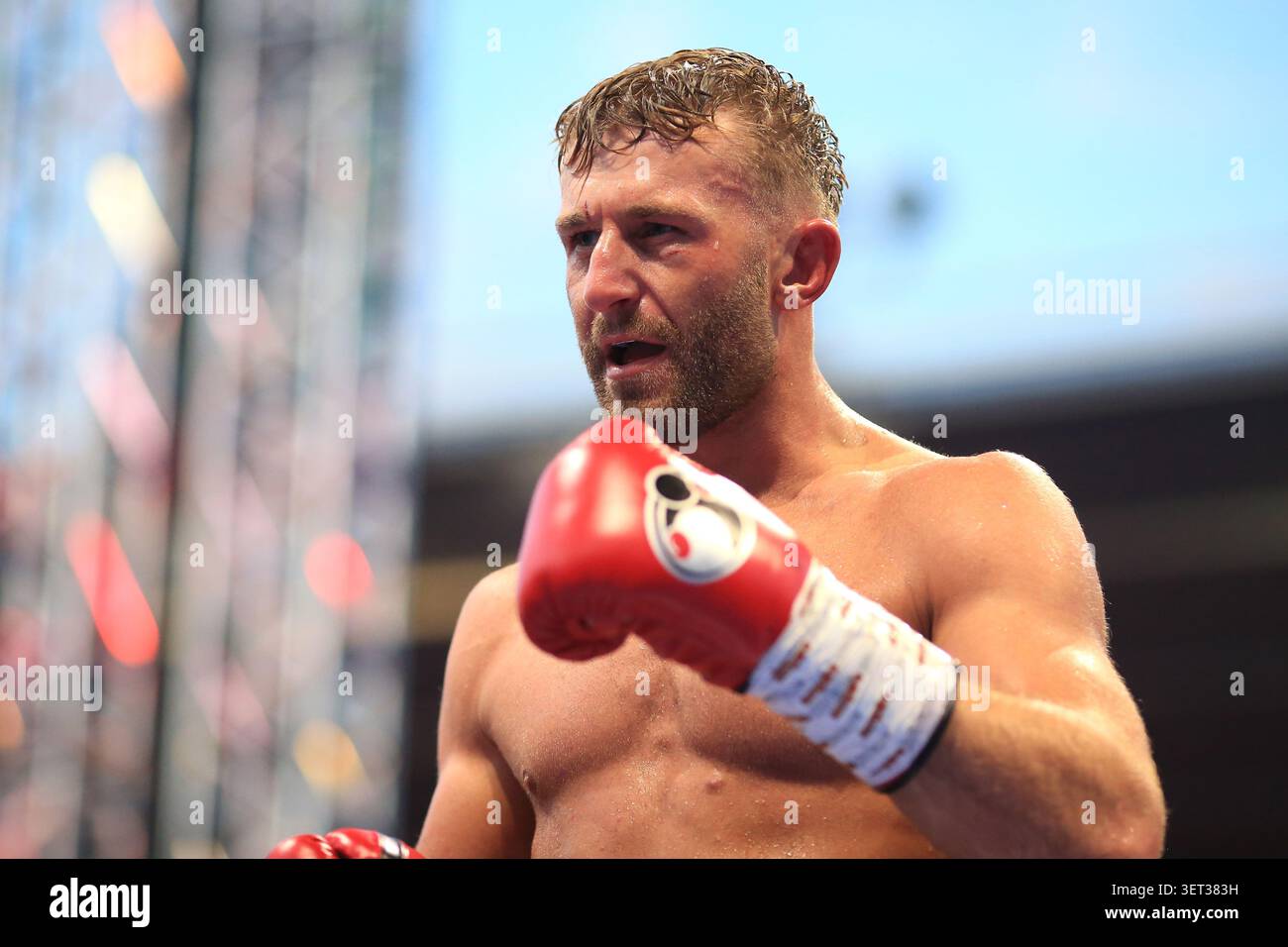 Lewis Edmondson after the middleweight bout against Lyndon Arthur (not ...