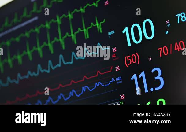 Detailed view of a patient monitor displaying vital signs and ECG ...