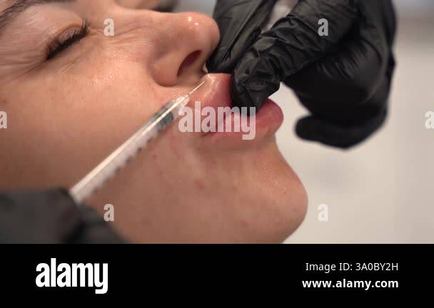 Cosmetologist doctor making multiple injections biorevitalization in ...