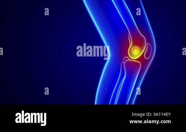 Painful knee animation. X-ray of leg with red pain circle in the knee ...