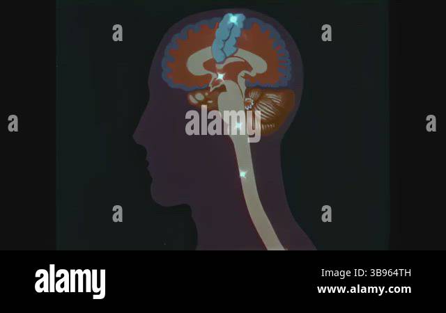 USA - 1979 - Animation is used to depict alcohol's affect on the brain ...