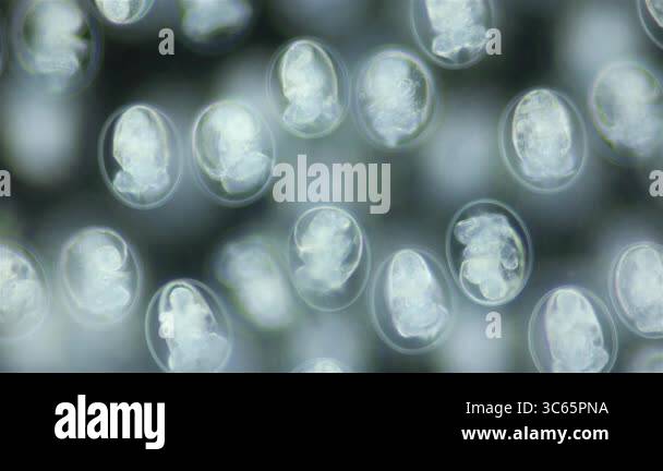 Light microscopy of larvae of a marine gastropod. These are the veliger ...