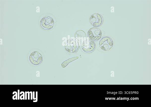 Larval cysts of the parasitic worm Lecithaster salmonis, light ...
