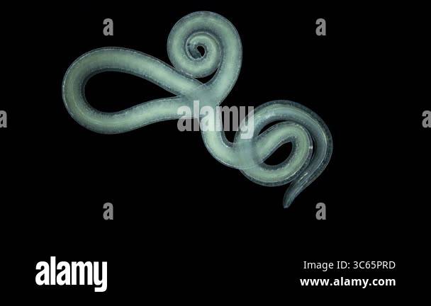 Light microscopy of a roundworm (phylum Nematoda). Specimen from the ...