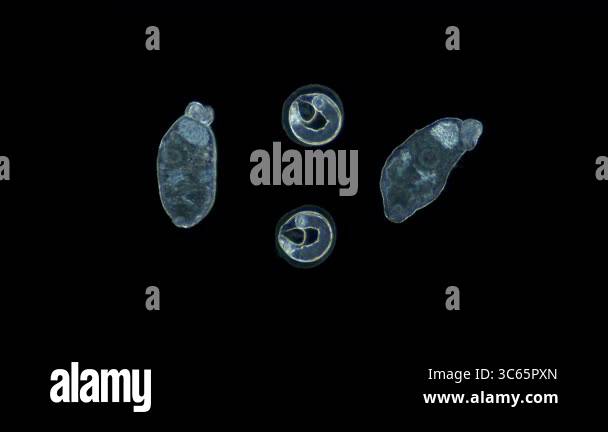 Larval cysts (round) and adults of the parasitic worm Lecithaster ...