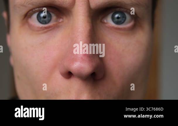 Man pressing red pimple with fingers. Inflammation on face. Visit to ...