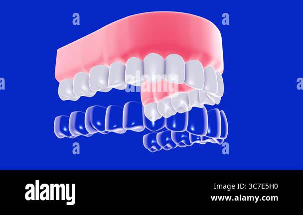 3D animation of a dental cap in a transparent glass graphic style ...