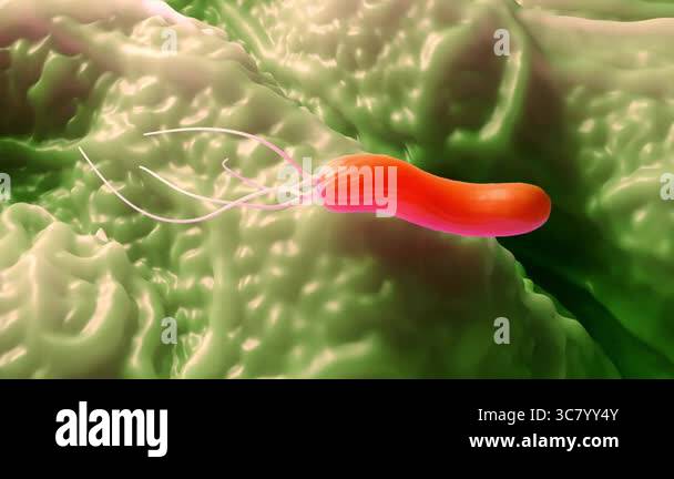 Helicobacter pylori bacteria, is a gram-negative, flagellated, helical ...