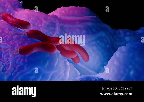 Helicobacter pylori bacteria, is a gram-negative, flagellated, helical ...