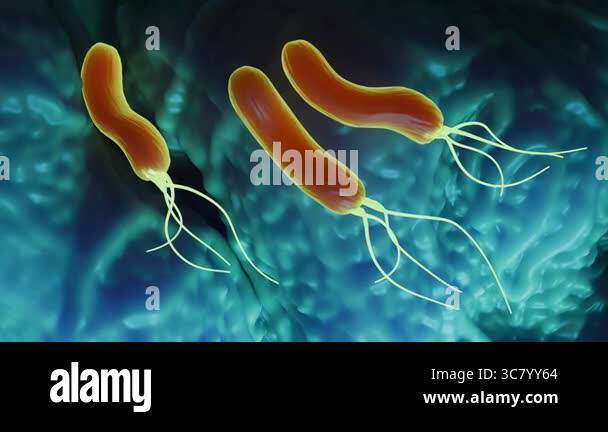 Helicobacter pylori bacteria, is a gram-negative, flagellated, helical ...