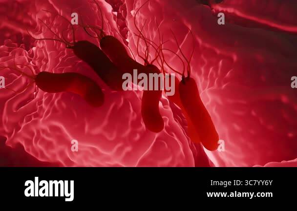 Helicobacter pylori bacteria, is a gram-negative, flagellated, helical ...
