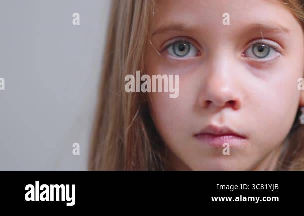 Closeup Of Young Girl With Blue Eyes And Serious Expression Looking