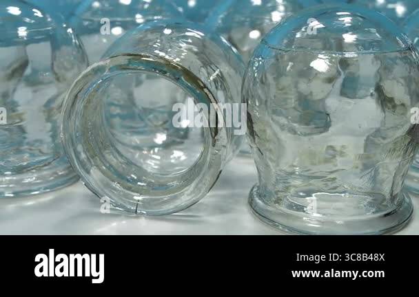 Medical cups for medical purposes - rehabilitation, back treatment ...
