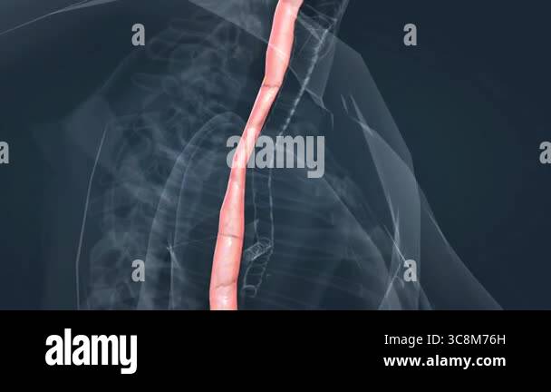 3D animation of human gastrointestinal system anatomy, illustrating the ...