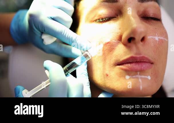 Attractive young woman is getting a rejuvenating facial injections at ...
