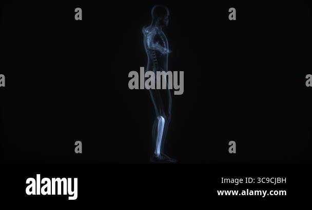 Tibia and fibula in human body. X ray. Loop Stock Video Footage - Alamy