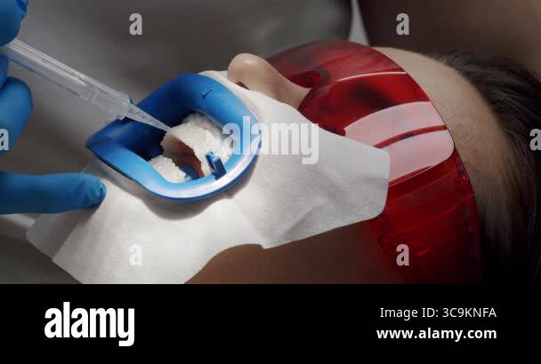 Modern dental clinic. Close up Oral hygiene and prophylactic cleaning ...