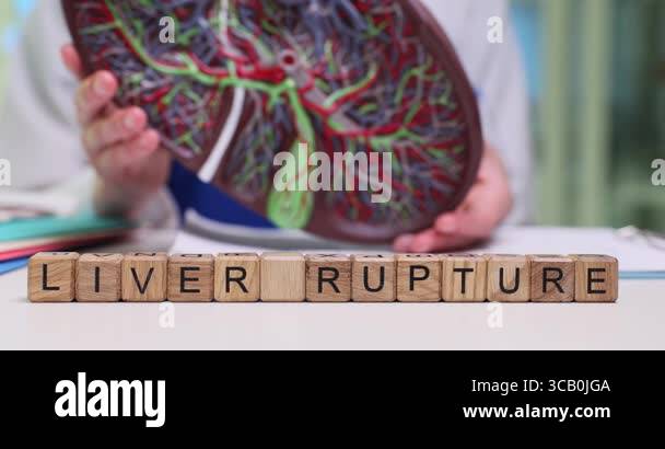 Delve into the complex nature of liver rupture and its significant ...