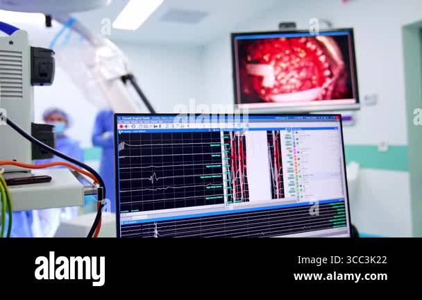 Monitors of equipment working in the surgical room. Screens display ...