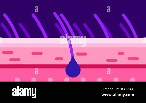 A skin cross-section showing animated hair follicles, illustrating hair ...