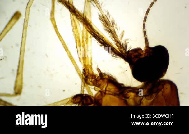 Low magnification (40x) microscope video of a whole mount of a female ...