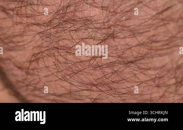 Extreme close-up macro shot revealing the detailed texture of human ...
