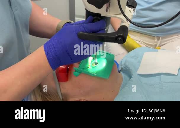 Cofferdam dental treatment under a microscope rubber band in dentistry ...