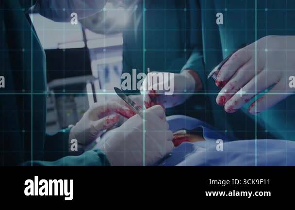 Lead surgeon incising drape with scalpel for surgery, grid animating as assistant handing ...