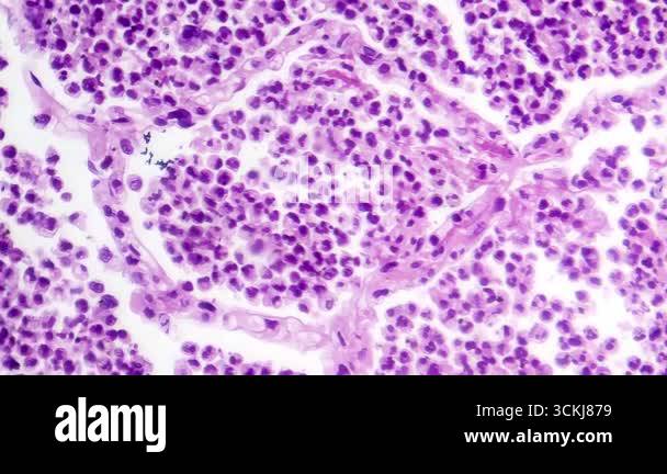 Human cerebellar cortex, light microscopy showing Purkinje cells ...