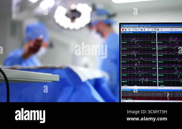 Kyiv, Ukraine, 2 May 2025: Neurosurgeons in brain surgery operation ...