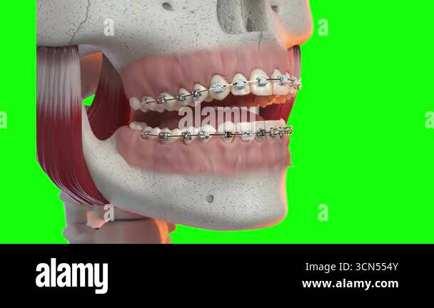Human upper jaw anatomy model Stock Videos & Footage - HD and 4K Video ...