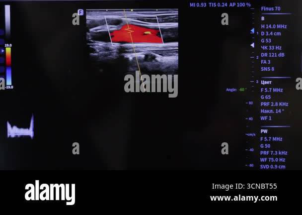 Pulse doppler technology Stock Videos & Footage - HD and 4K Video Clips ...