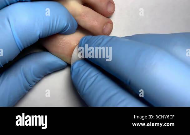 Treat swelling of hands Stock Videos & Footage - HD and 4K Video Clips ...