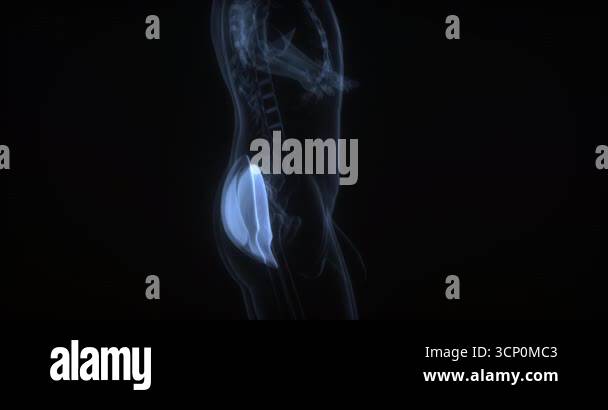 Gluteus Maximus in human body. X Ray. Loop Stock Video Footage - Alamy