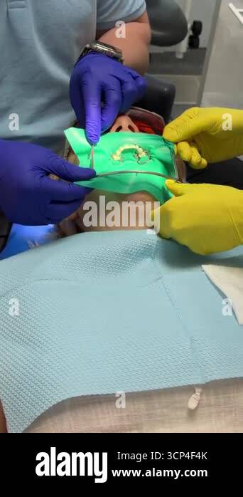 Cofferdam rubber band in dentistry on teeth water does not get into the ...