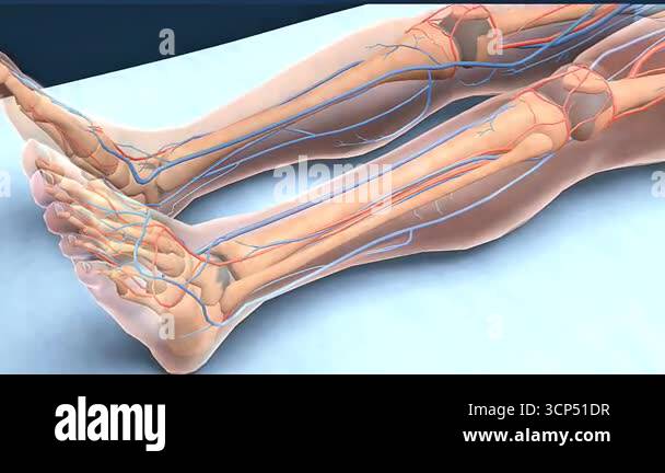 3D animation of thrombus formation, showing blood clot development ...
