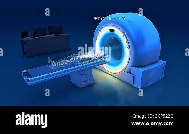 3d scan procedure Stock Videos & Footage - HD and 4K Video Clips - Alamy