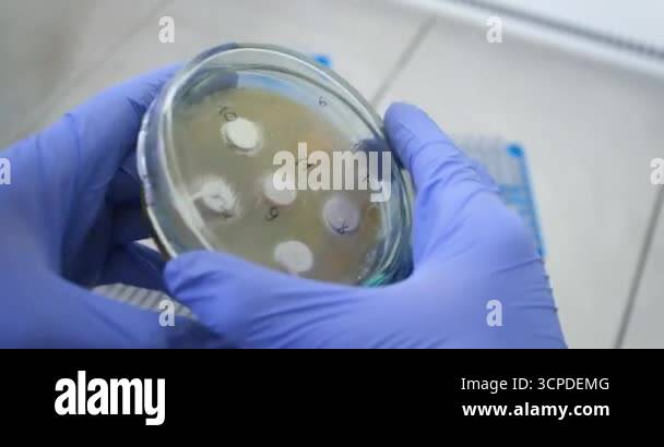 Close-up, a scientist examines bacteria in a petri dish that have grown ...