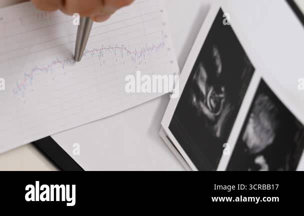 The doctor looks at the fetal cardiotocography. Vertical video Stock ...
