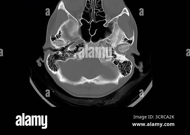 MRI Brain Scan Analysis: Examining Neural Structures and Potential ...