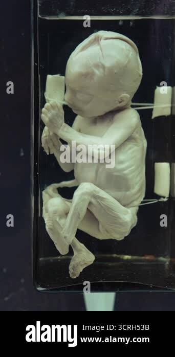 Human model medical museum view Stock Videos & Footage - HD and 4K ...