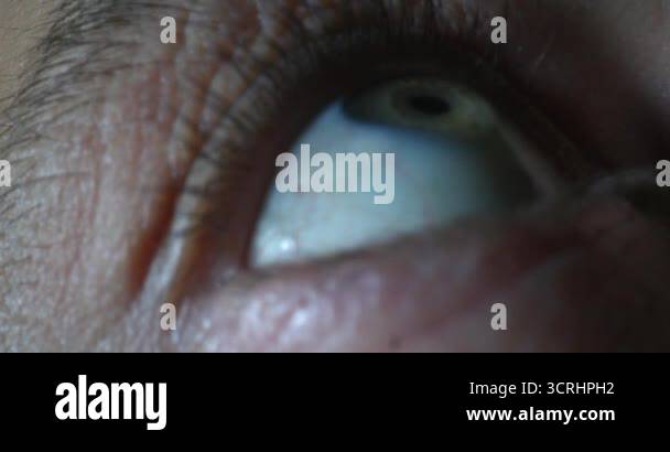 A close-up examination focusing on a patients eye shows a visible eye ...