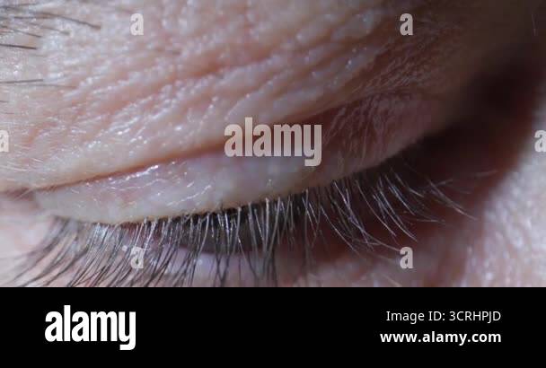 This close-up captures the fine textures of human skin and eyelashes ...