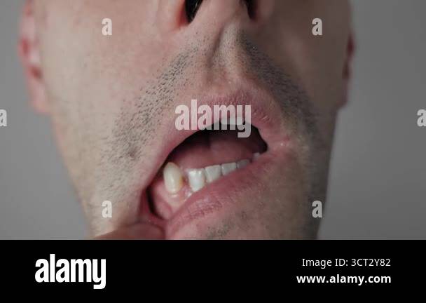 Macro shot of a mans open mouth with stubble. He uses his finger to ...